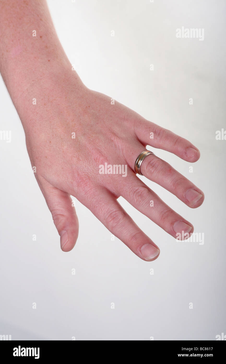 Wedding ring on finger Stock Photo - Alamy