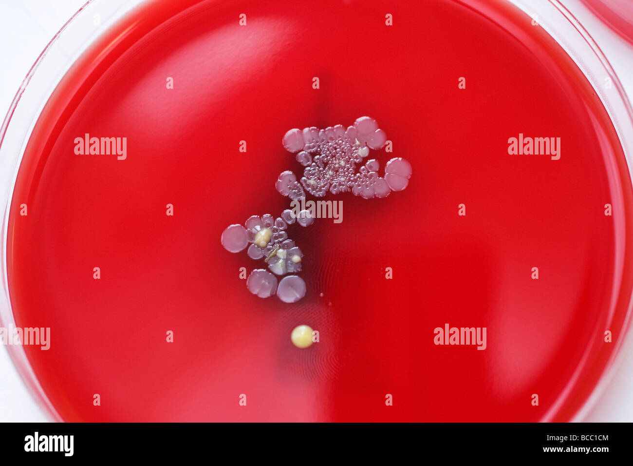 Staphylococcus Epidermis Epidermidi