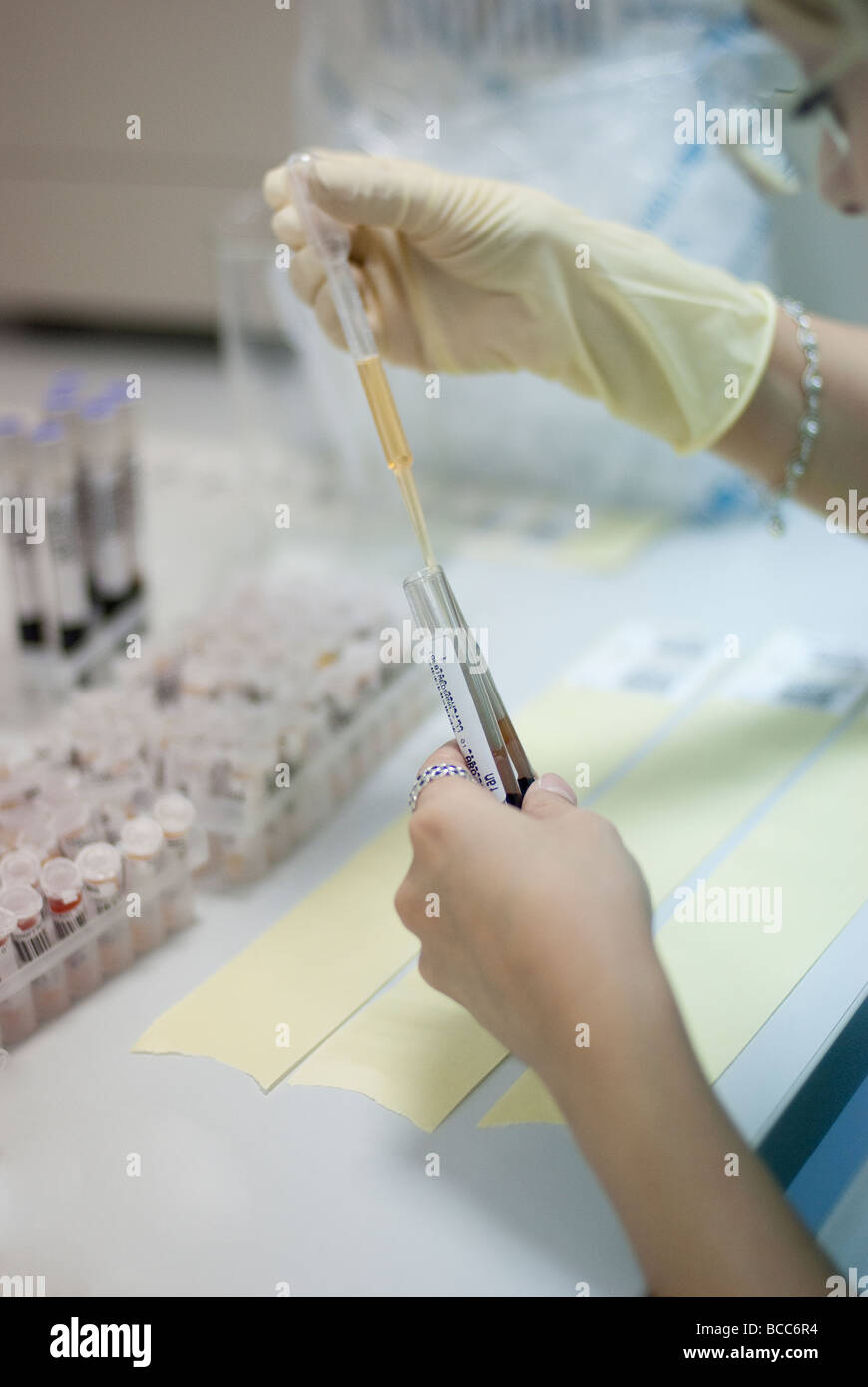 Blood infection hi-res stock photography and images - Alamy