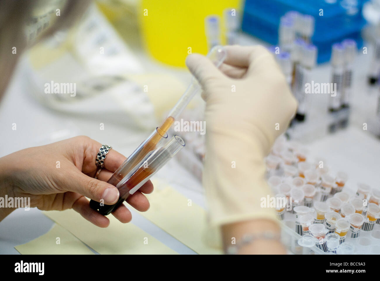 Hands of a woman are taking blood samples using a dropper Stock Photo ...