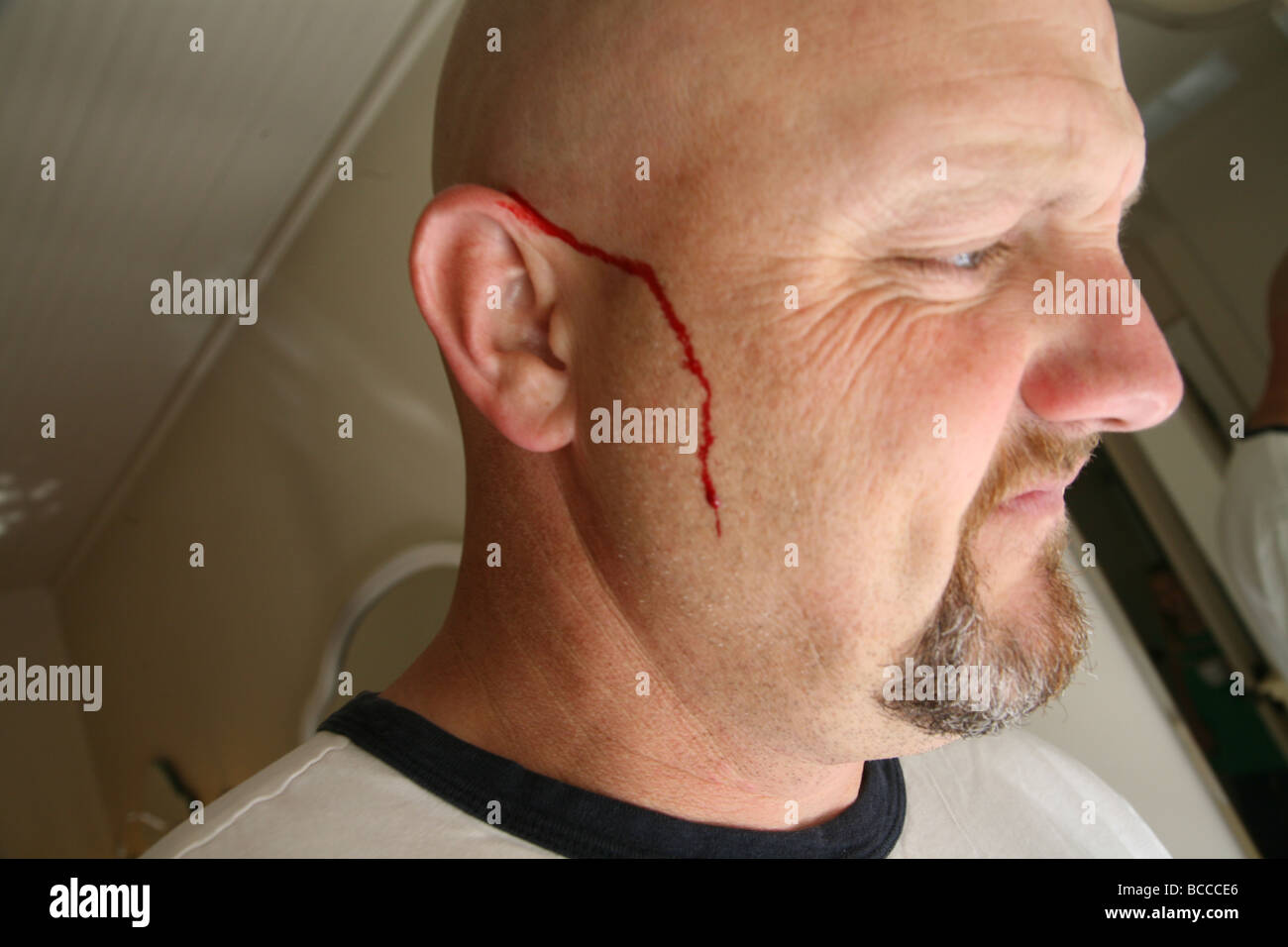 Bleeding ear hi-res stock photography and images - Alamy