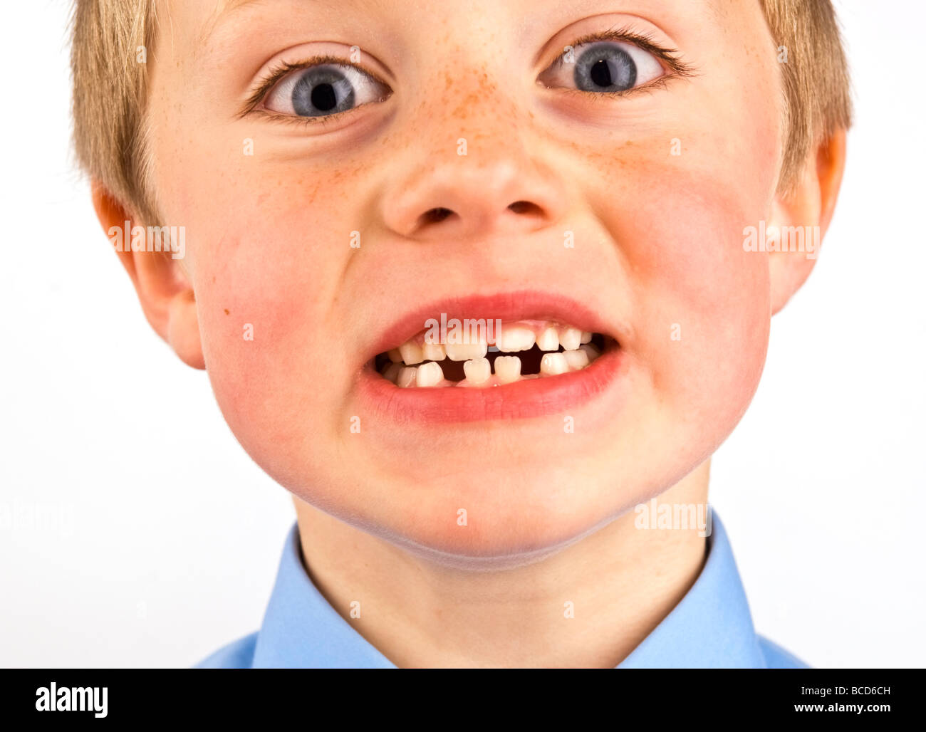 school boy with missing teeth Stock Photo - Alamy