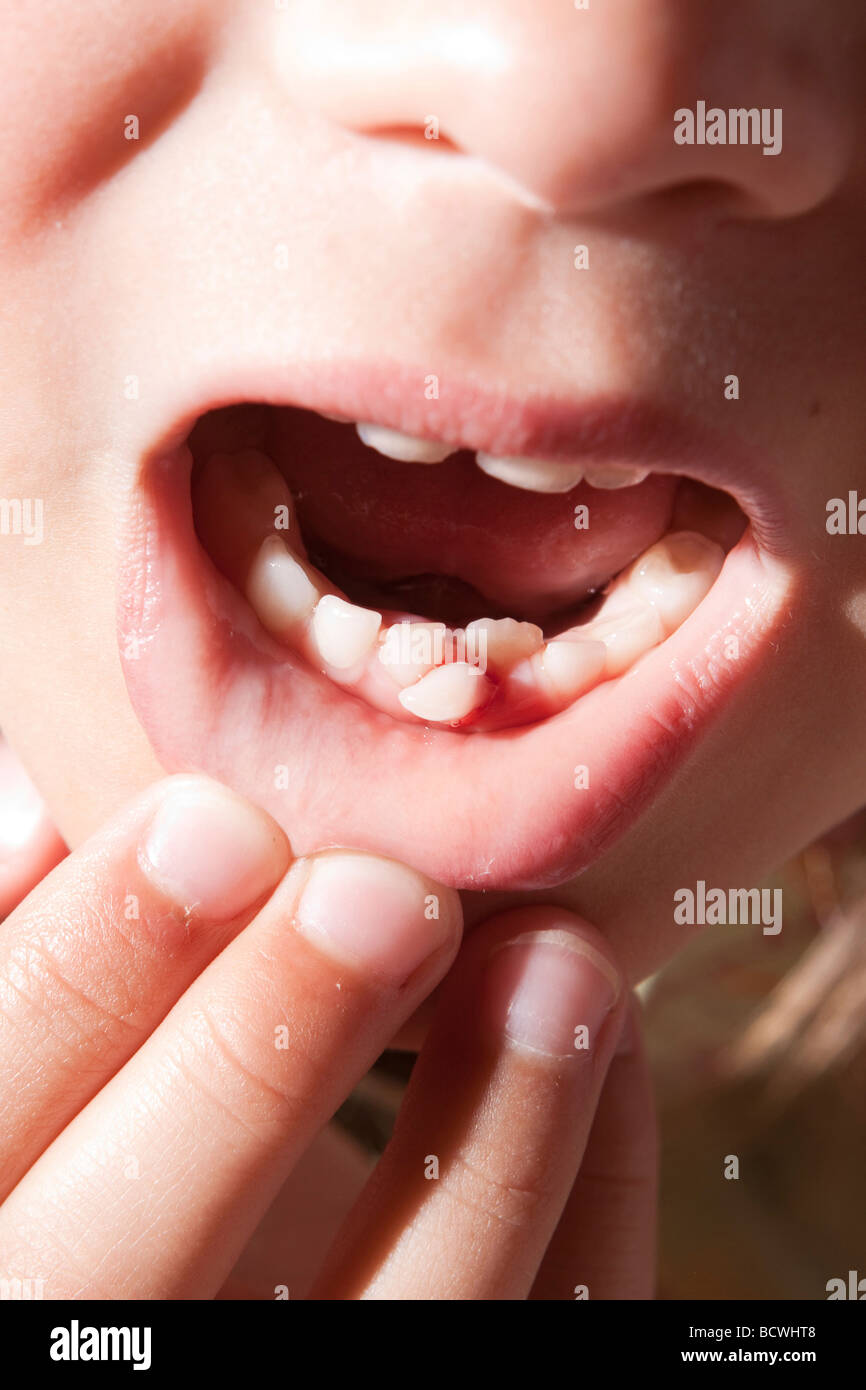 Milkteeth hi-res stock photography and images - Alamy