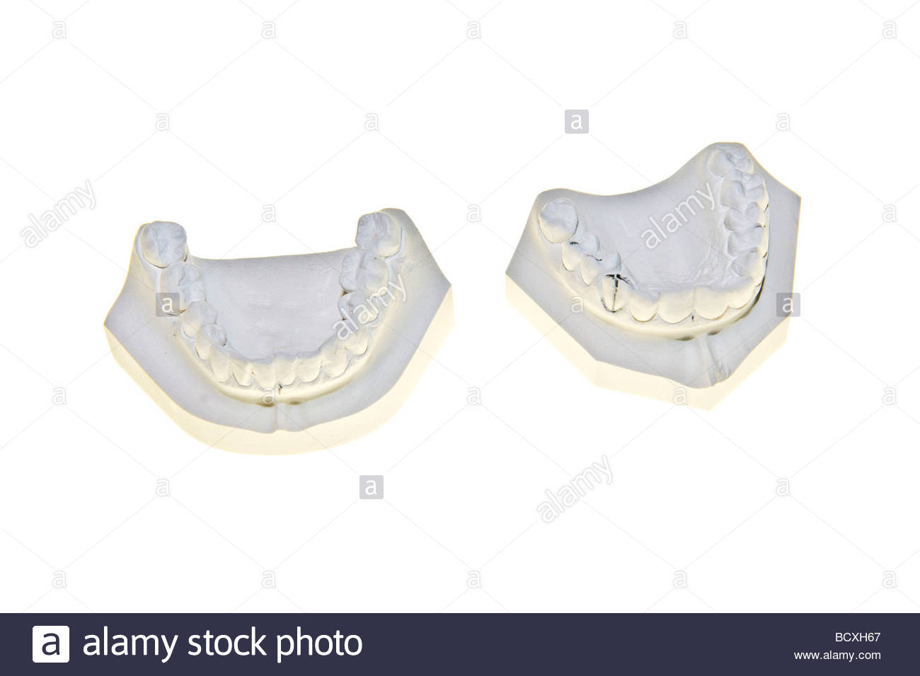 Teeth Mold Stock Photos & Teeth Mold Stock Images - Alamy
