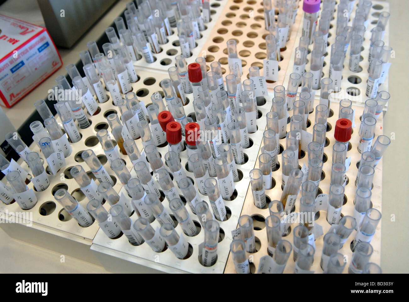 Milan (Italy), hospital Sacco for infectious diseases, laboratory of ...