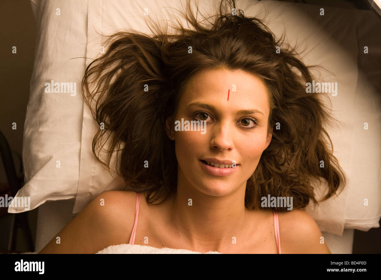 Open acupuncture hi-res stock photography and images - Alamy