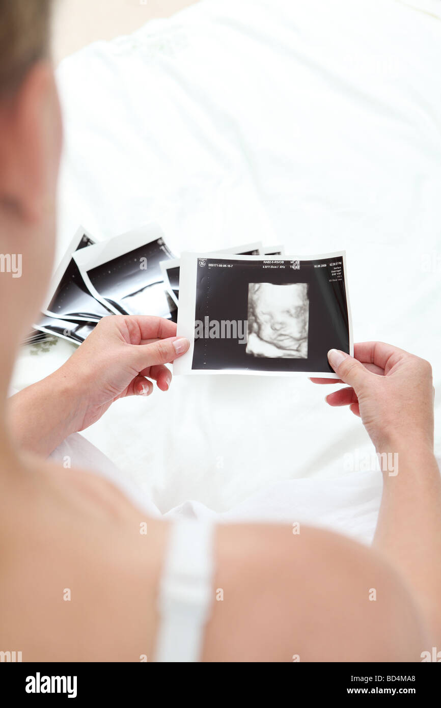 3d baby scan hi-res stock photography and images - Alamy