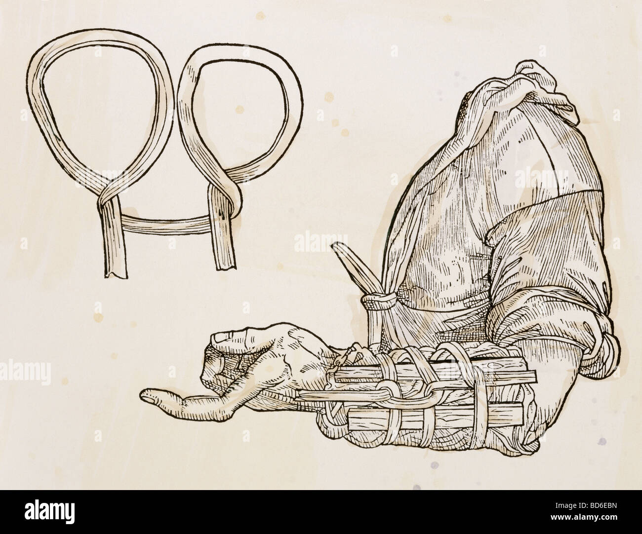 Splinting the injury hi-res stock photography and images - Alamy