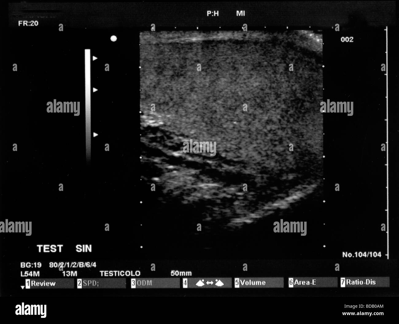 Testis testes Black and White Stock Photos & Images - Alamy