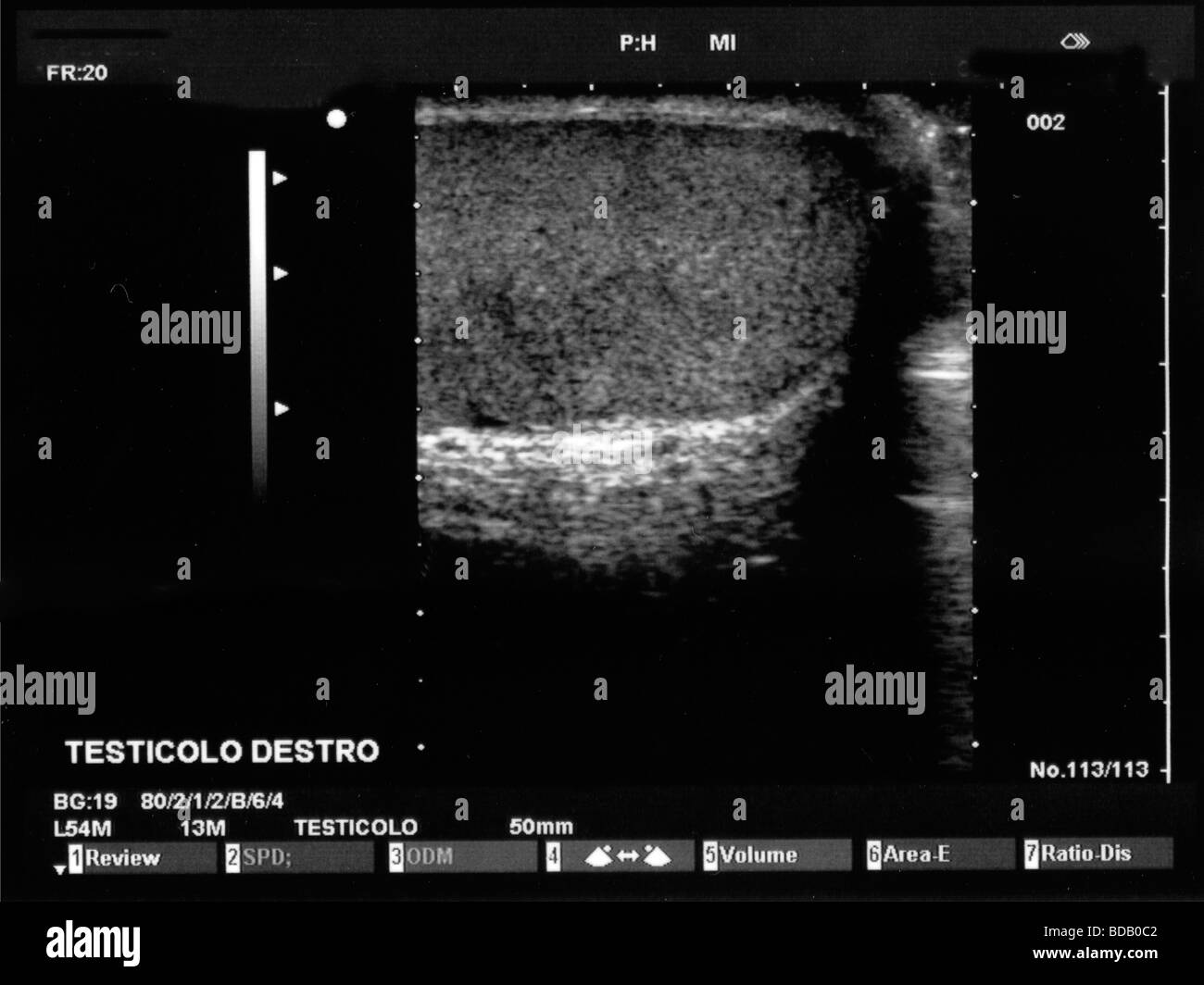 Testis testes hi-res stock photography and images - Alamy