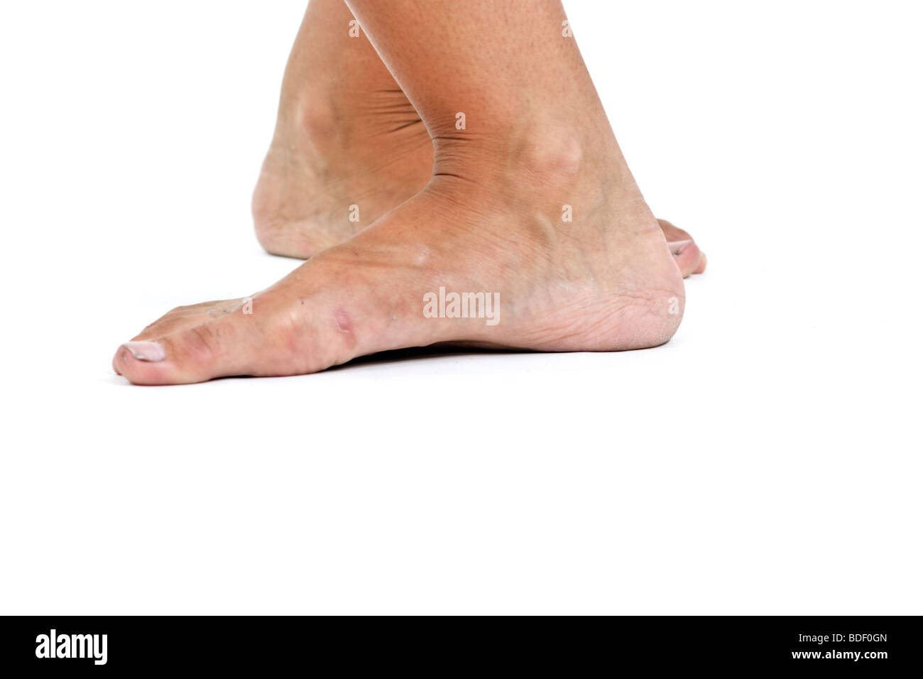Bruised feet hi-res stock photography and images - Alamy