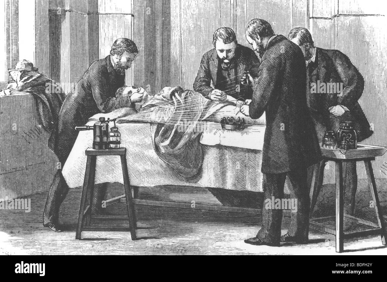 Joseph Lister Pioneer Of Antiseptic Surgery Design Week Joseph Lister Pioneer Of Antiseptic Surgery Design Week