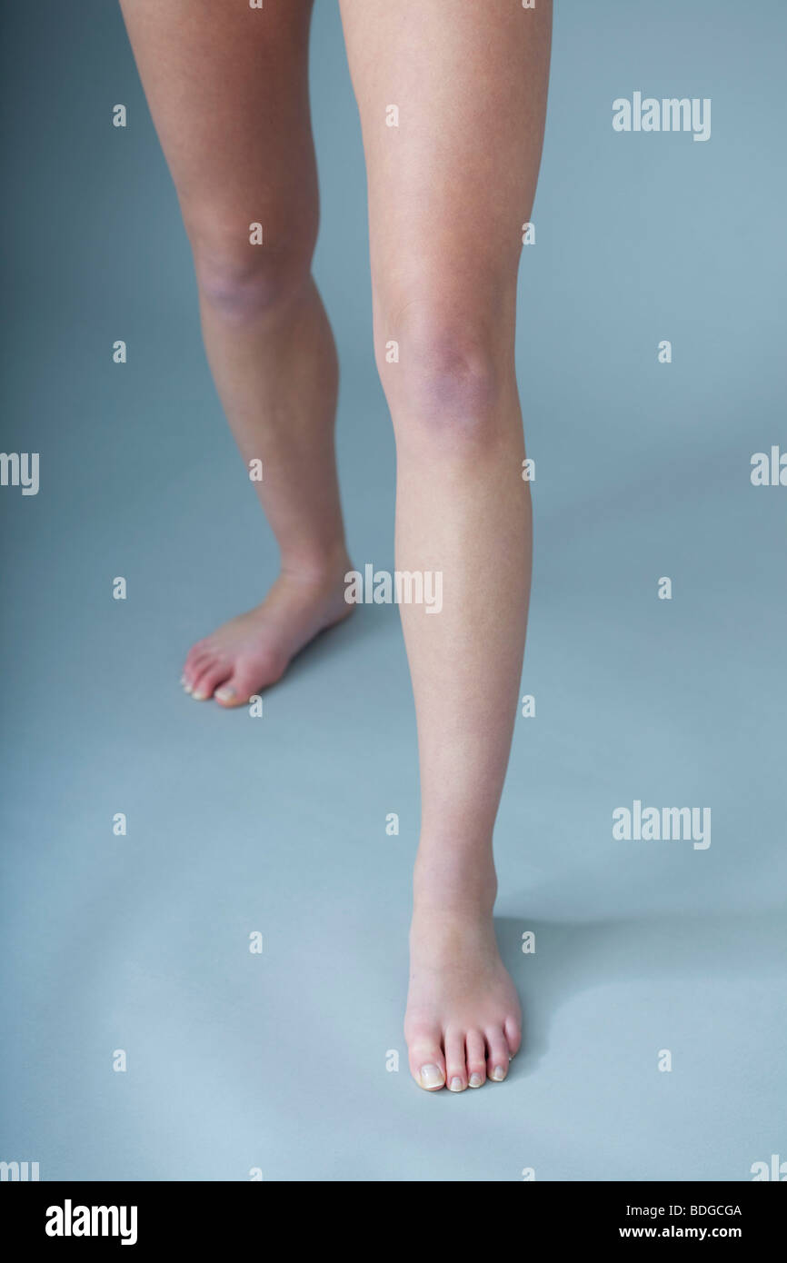 Lower Leg High Resolution Stock Photography and Images - Alamy