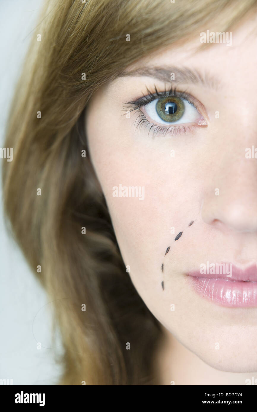 FACE PLASTIC SURGERY Stock Photo - Alamy