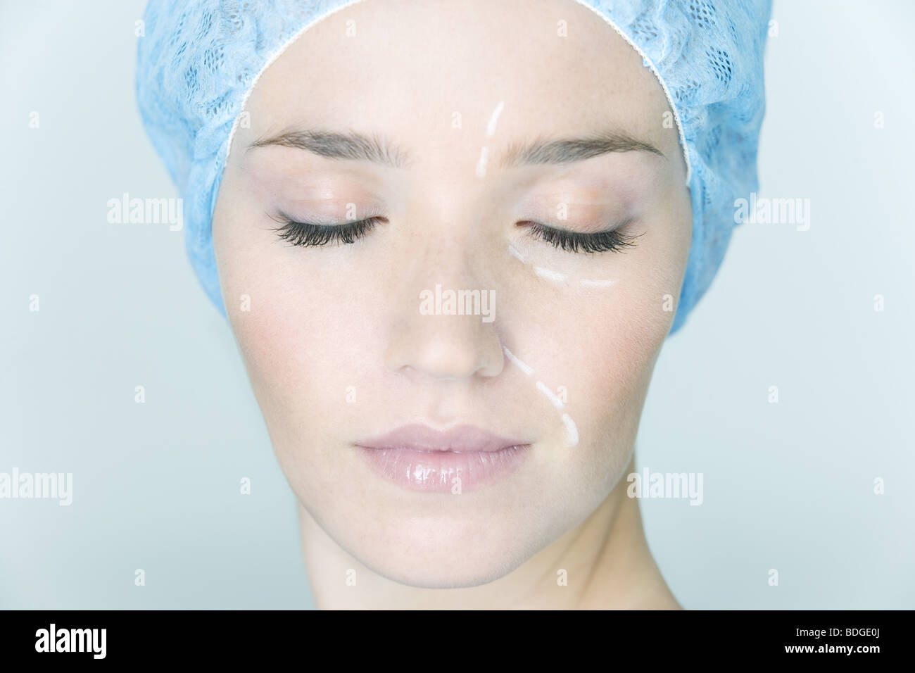 FACE PLASTIC SURGERY Stock Photo - Alamy