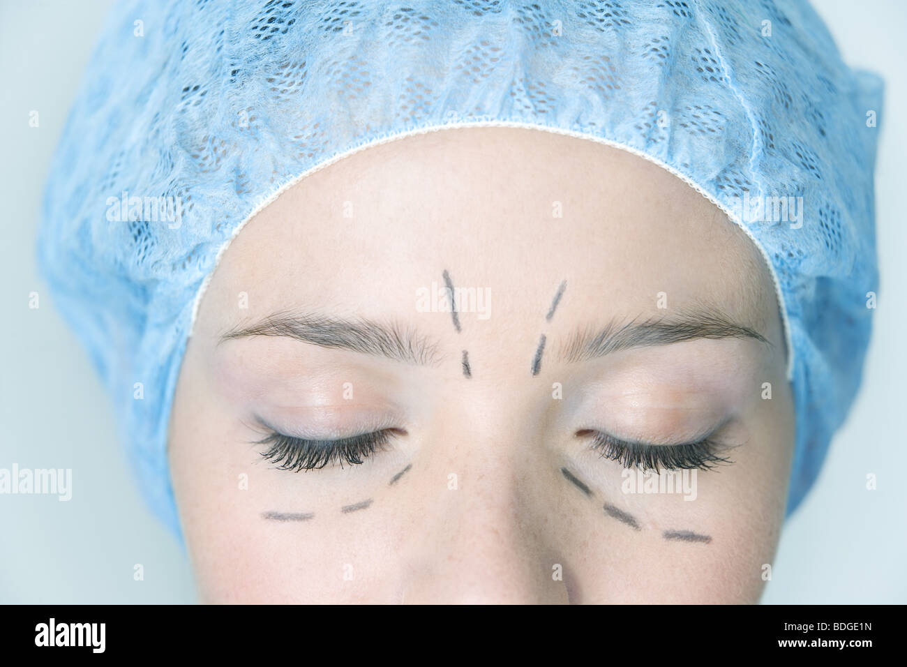 FACE PLASTIC SURGERY Stock Photo - Alamy