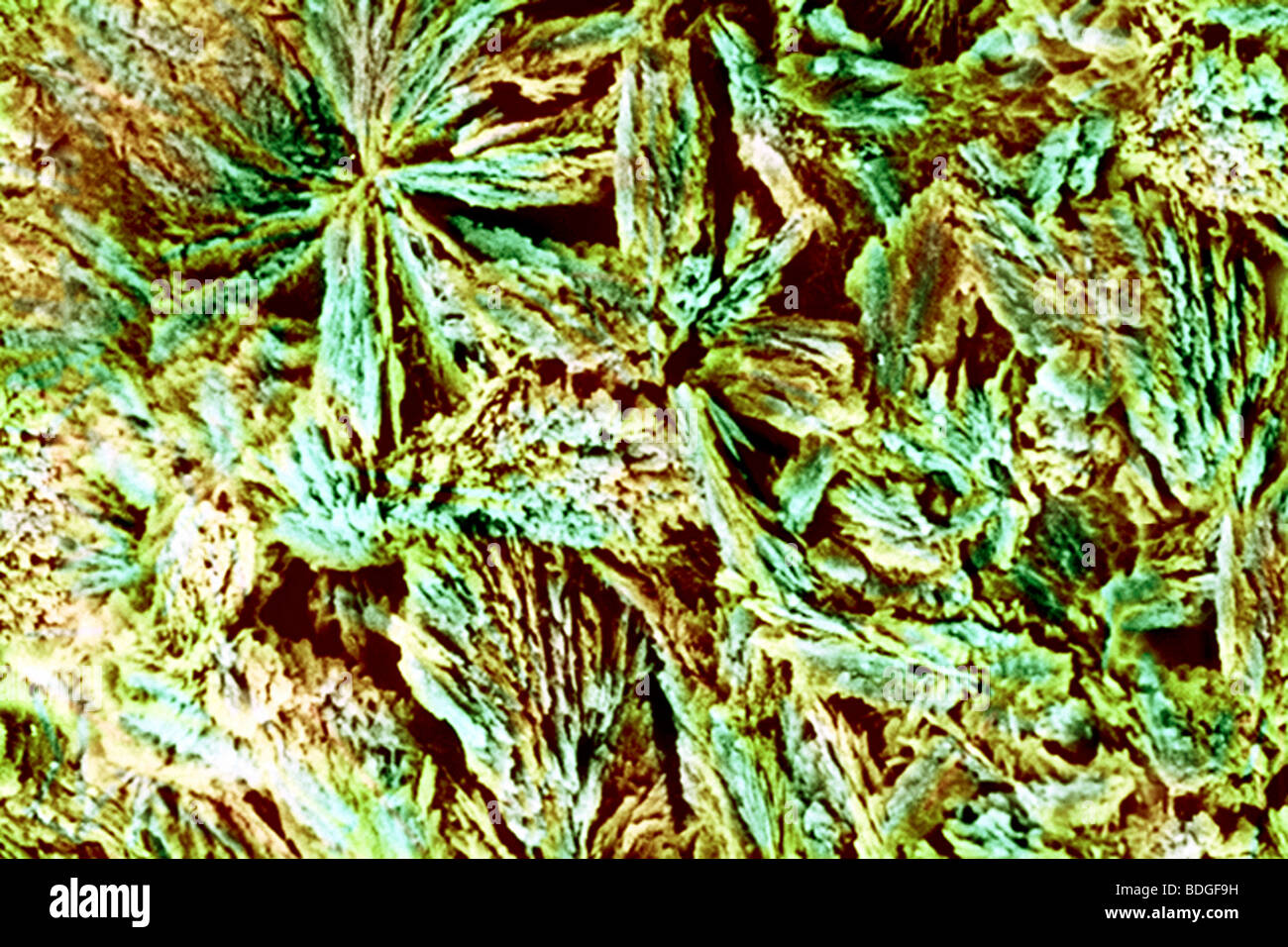 DENTAL TARTAR, SEM Stock Photo - Alamy