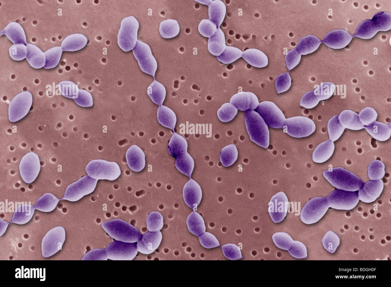 Streptococcus pneumoniae diplococci hi-res stock photography and images ...
