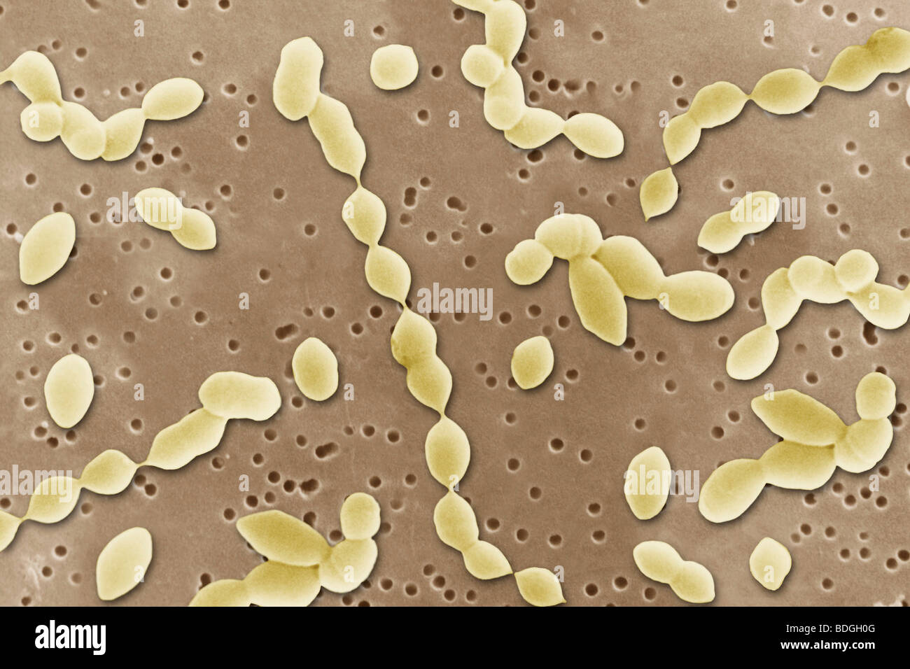 Streptococcus Pneumoniae Microscope High Resolution Stock Photography ...