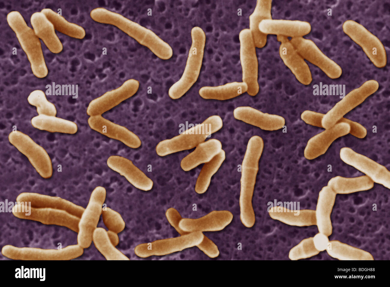 Corynebacteria hi-res stock photography and images - Alamy