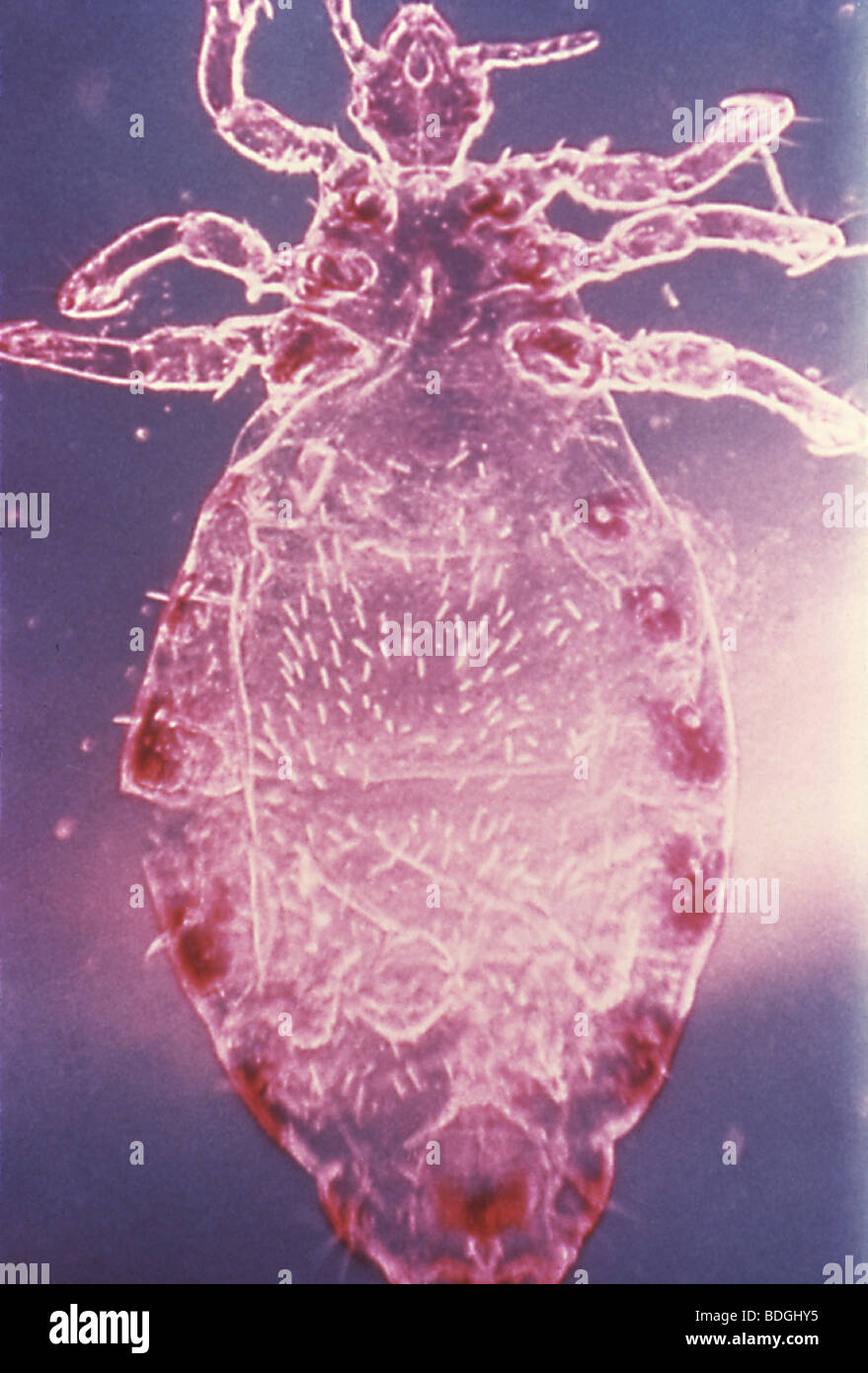 HUMAN HEAD LOUSE Stock Photo - Alamy