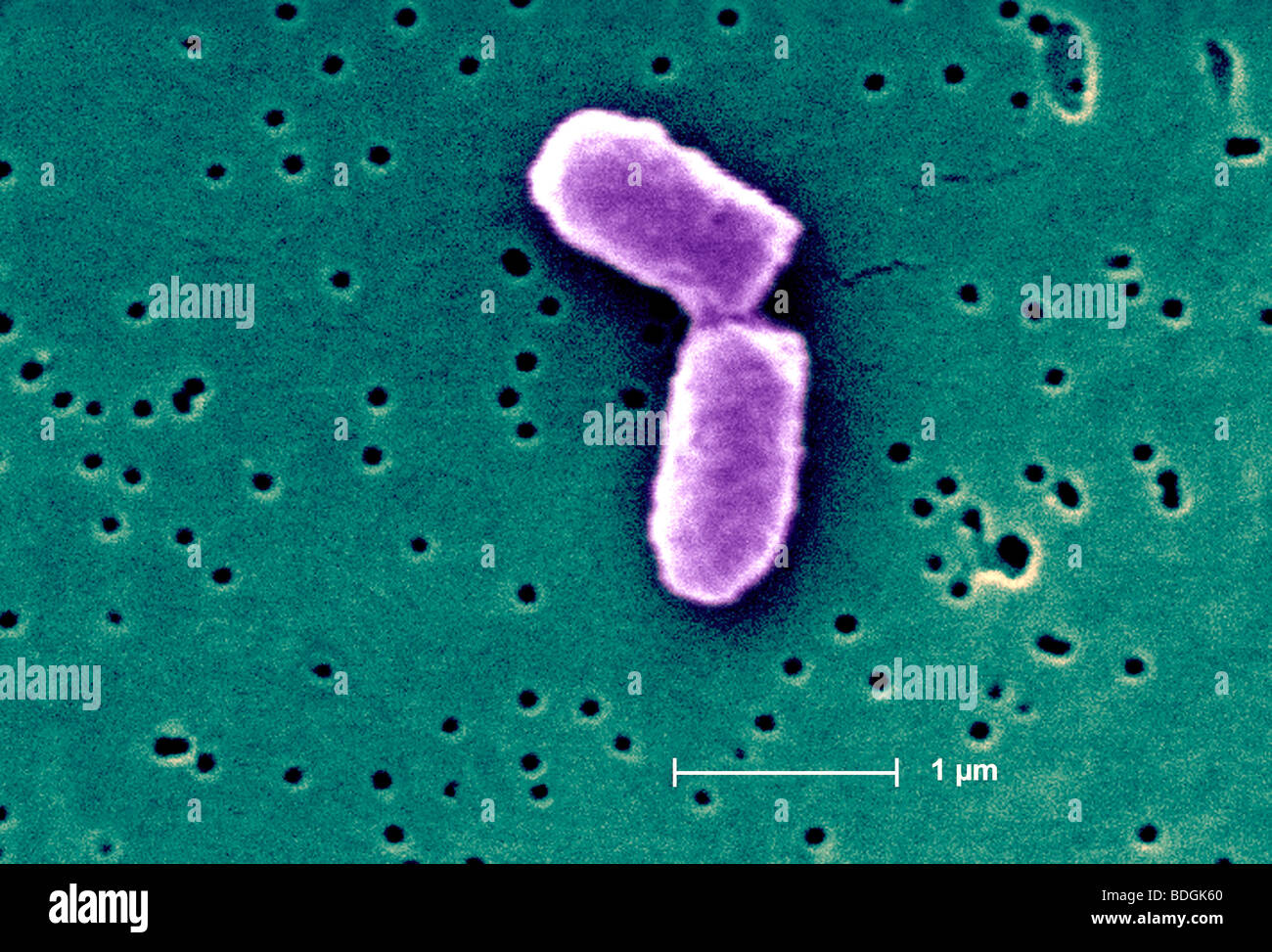 Escherichia coli micrograph hi-res stock photography and images - Alamy