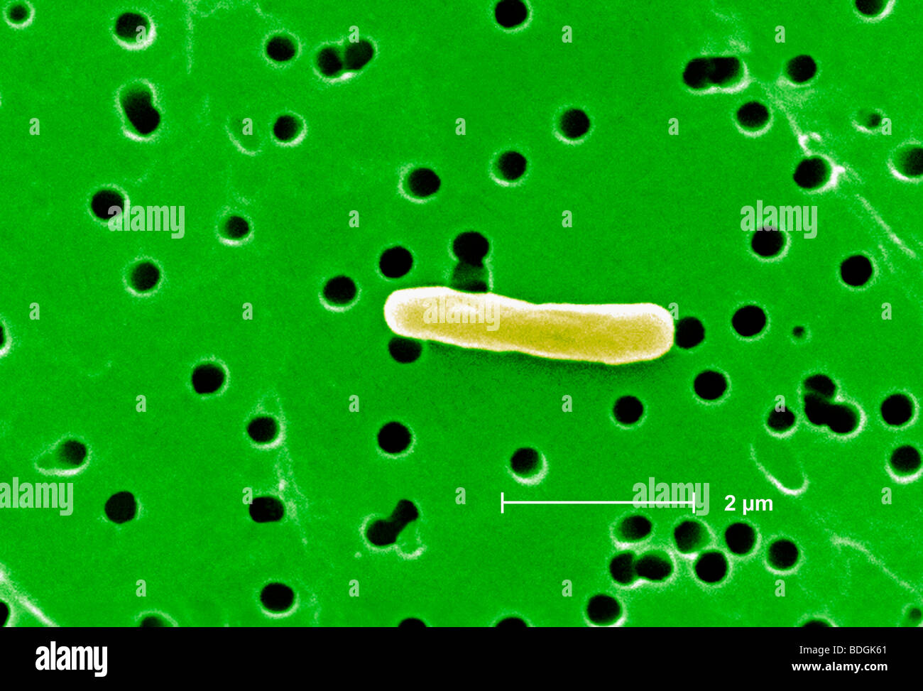Escherichia coli electron micrograph hi-res stock photography and ...
