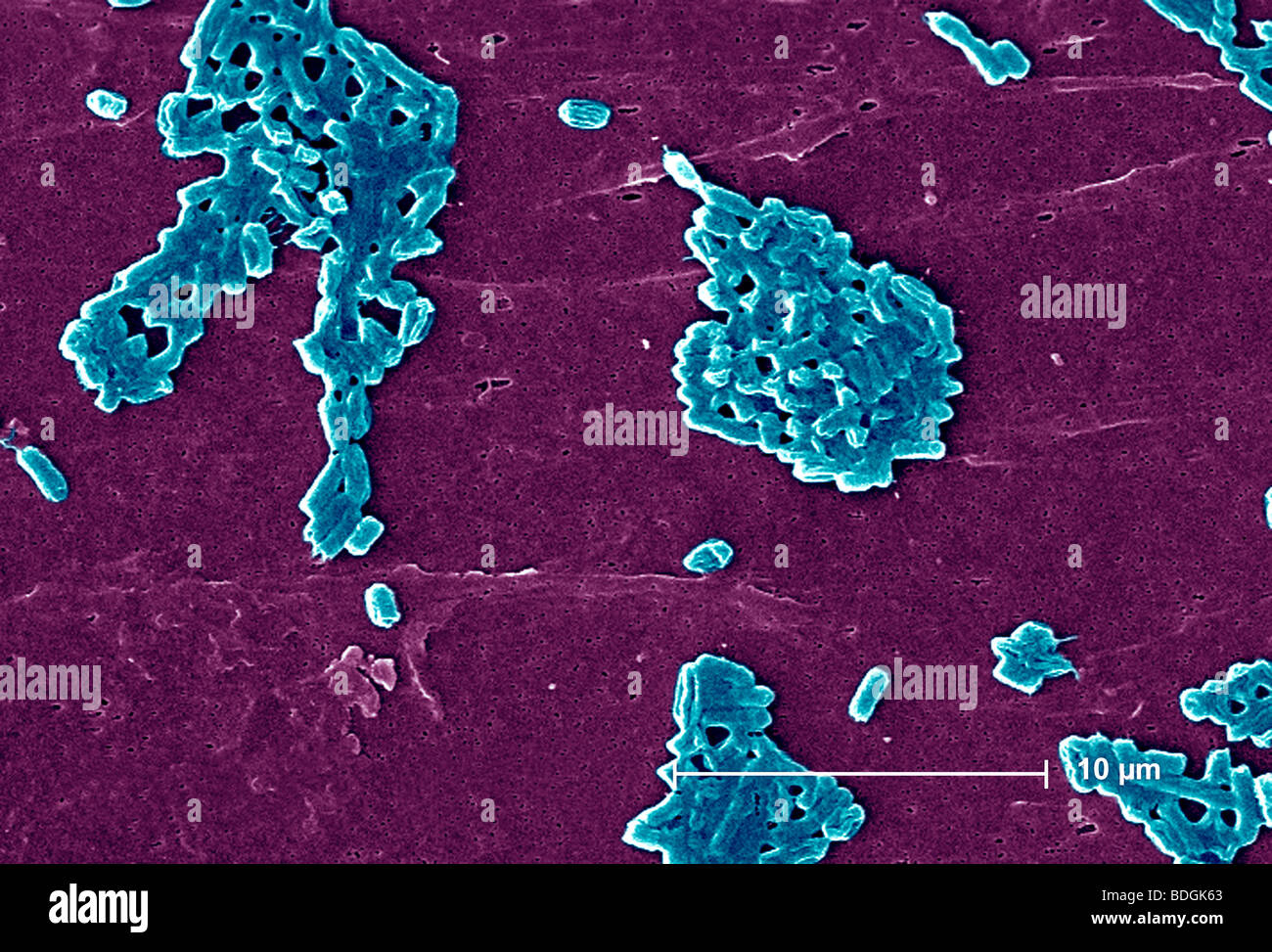 Bacteria sem e. coli hi-res stock photography and images - Alamy