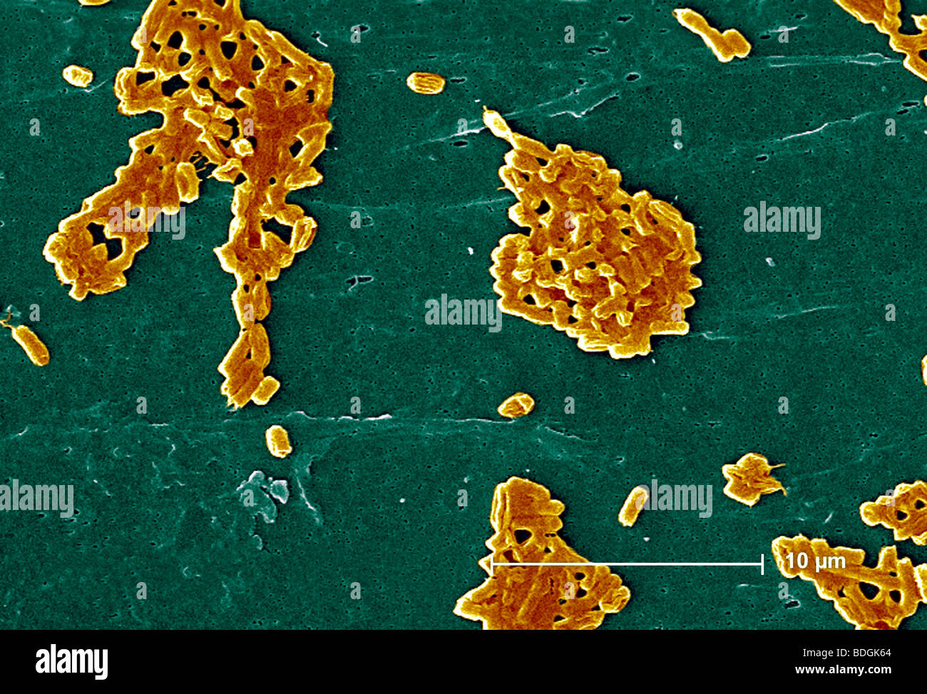 Escherichia coli electron micrograph hi-res stock photography and ...