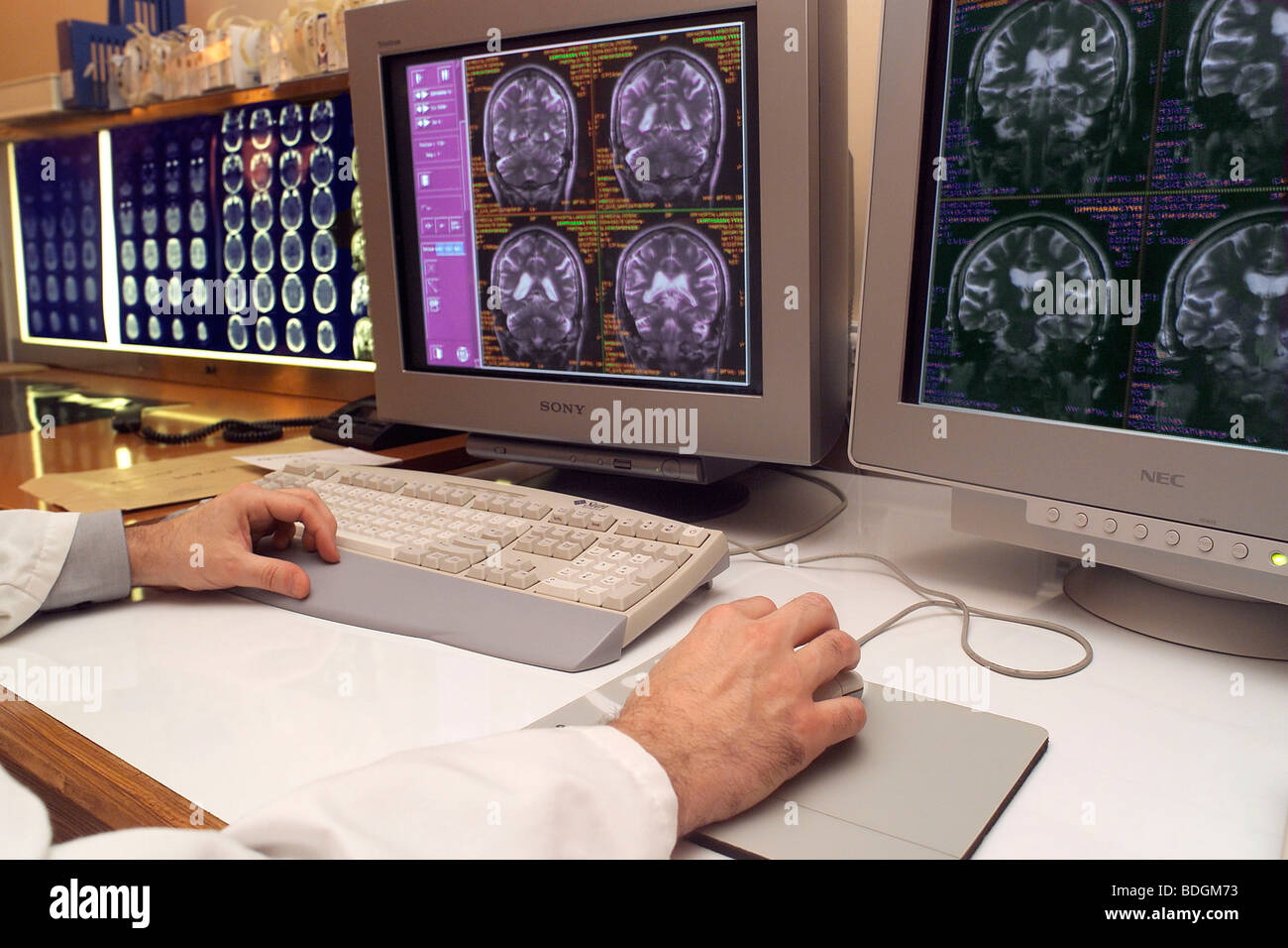 X ray nmr hi-res stock photography and images - Alamy