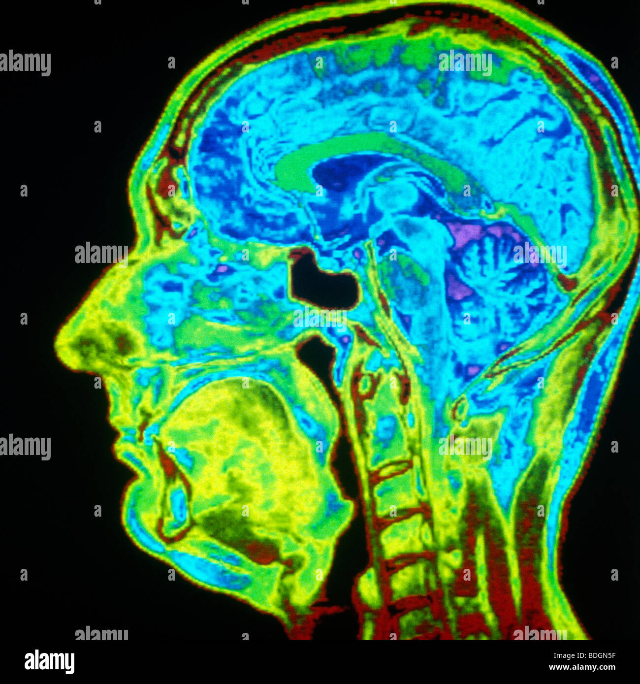 Nmr brain scan hi-res stock photography and images - Alamy