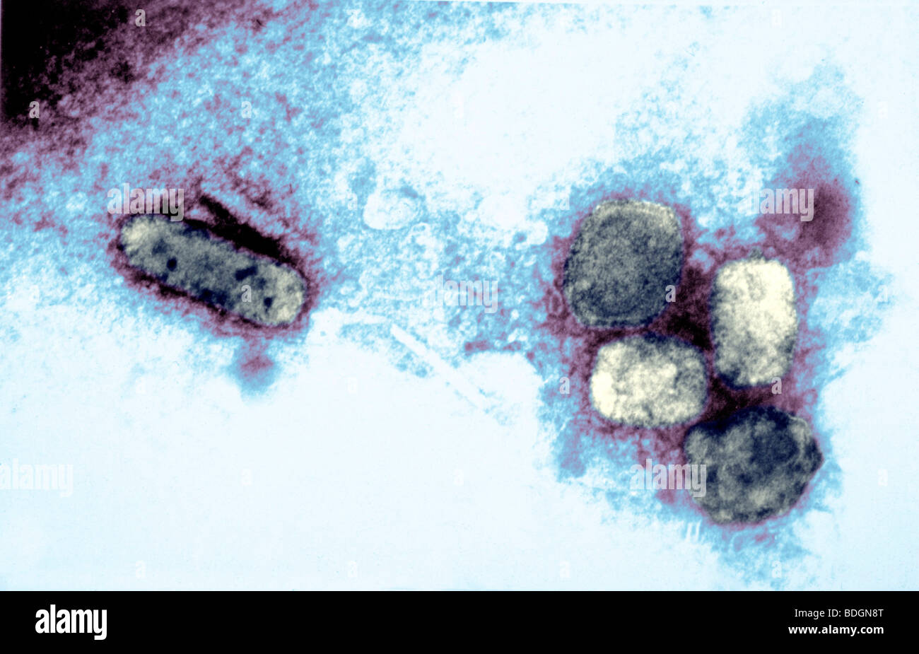 Smallpox virus microscope hi-res stock photography and images - Alamy