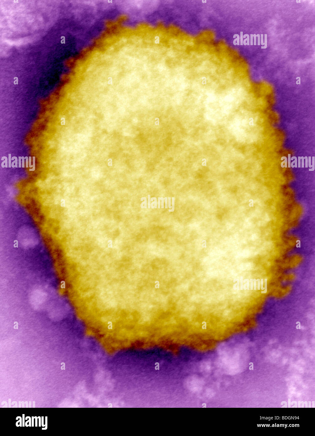 Smallpox virus microscope hi-res stock photography and images - Alamy