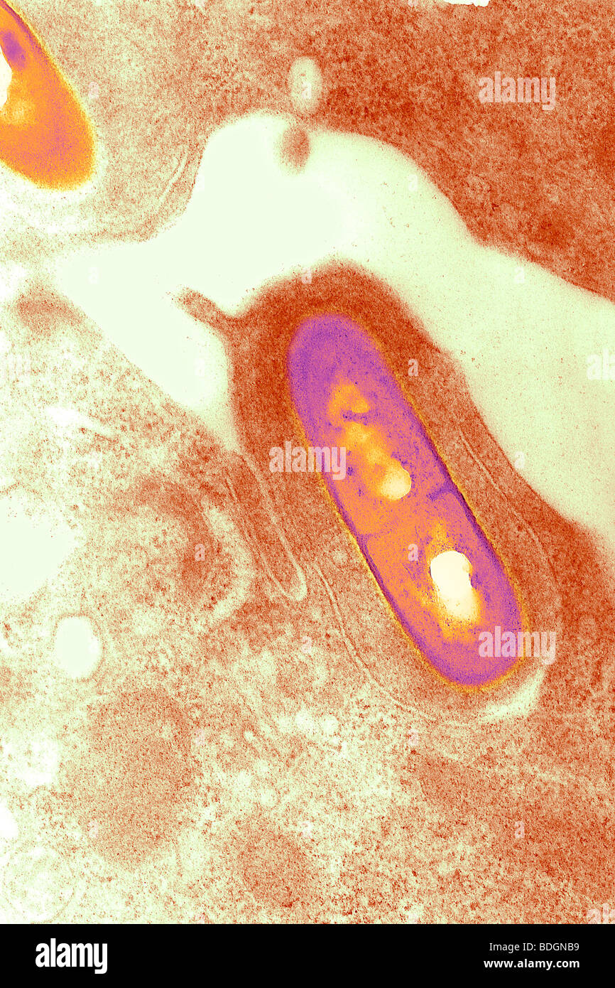 Listeriaceae hi-res stock photography and images - Alamy