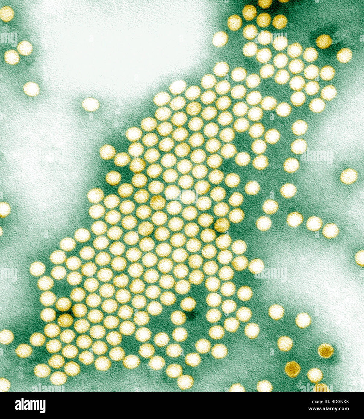 Polio virus micrograph hi-res stock photography and images - Alamy