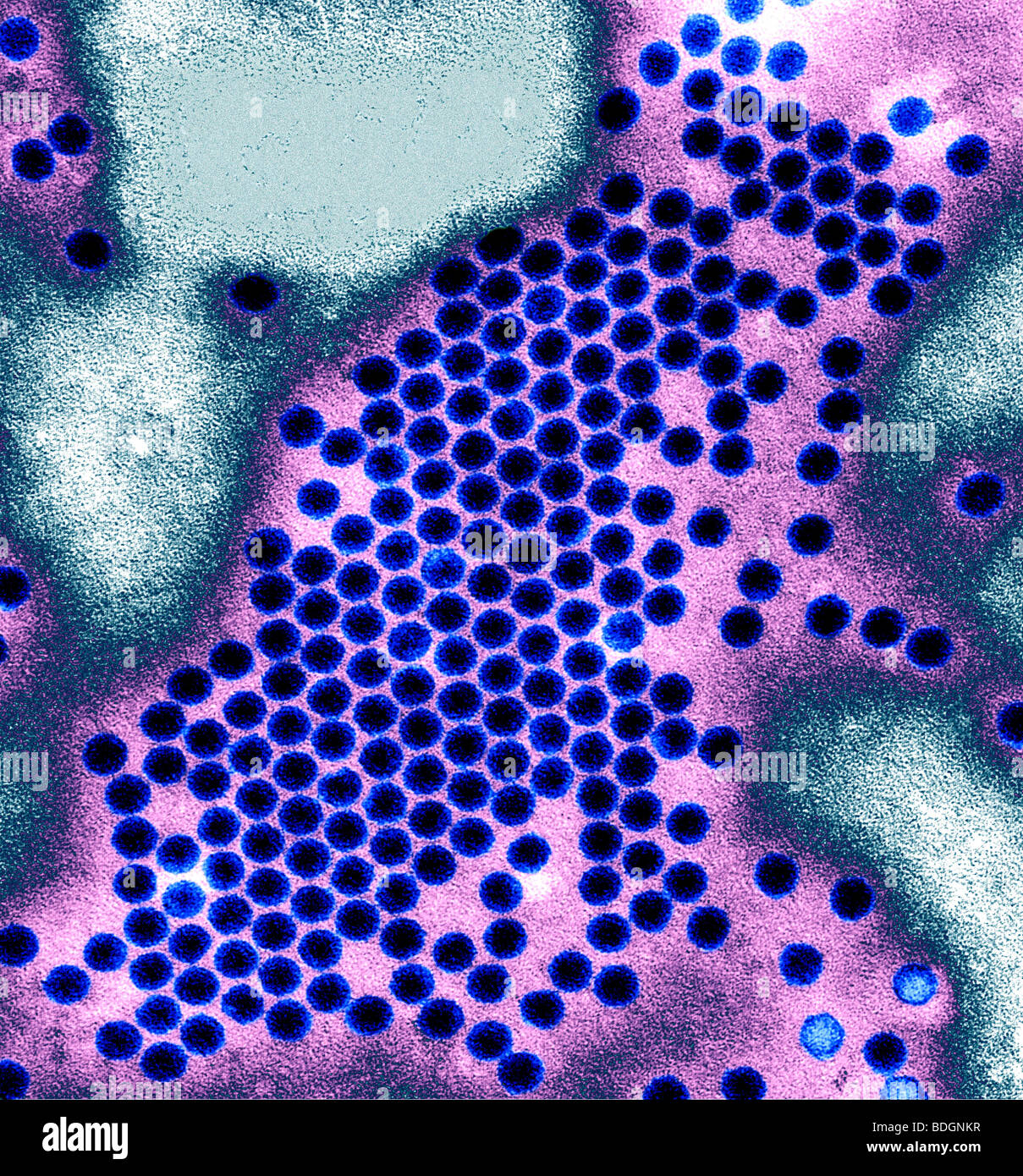 Micrografia Eletronica Do Poliovirus