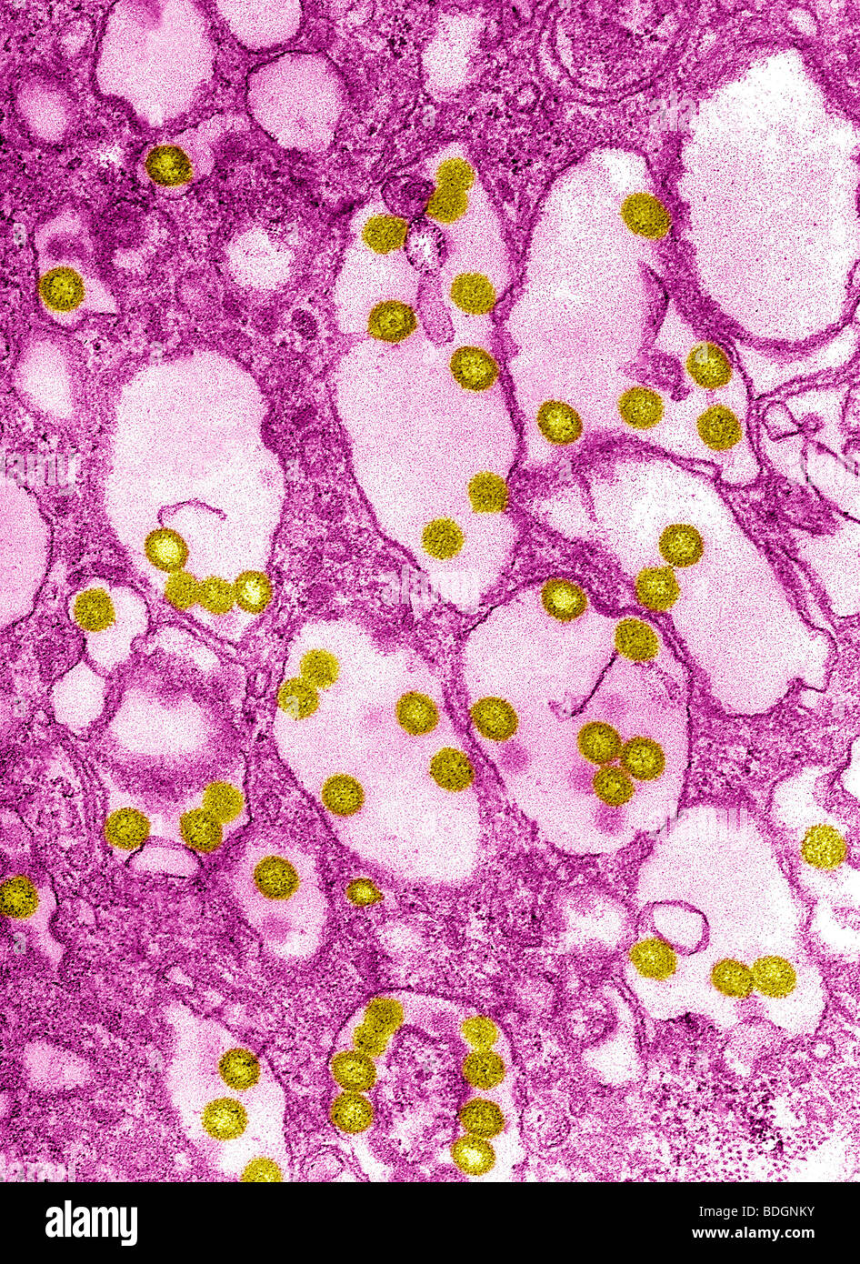 RIFT VALLEY FEVER VIRUS Stock Photo - Alamy