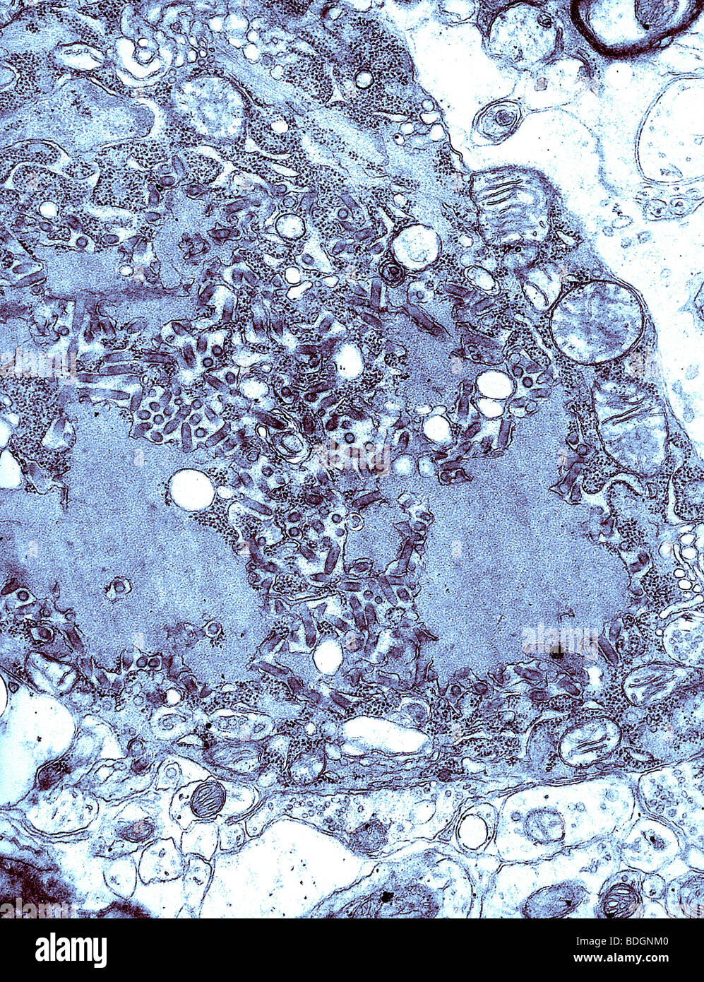 Rabies virus microscope hi-res stock photography and images - Alamy