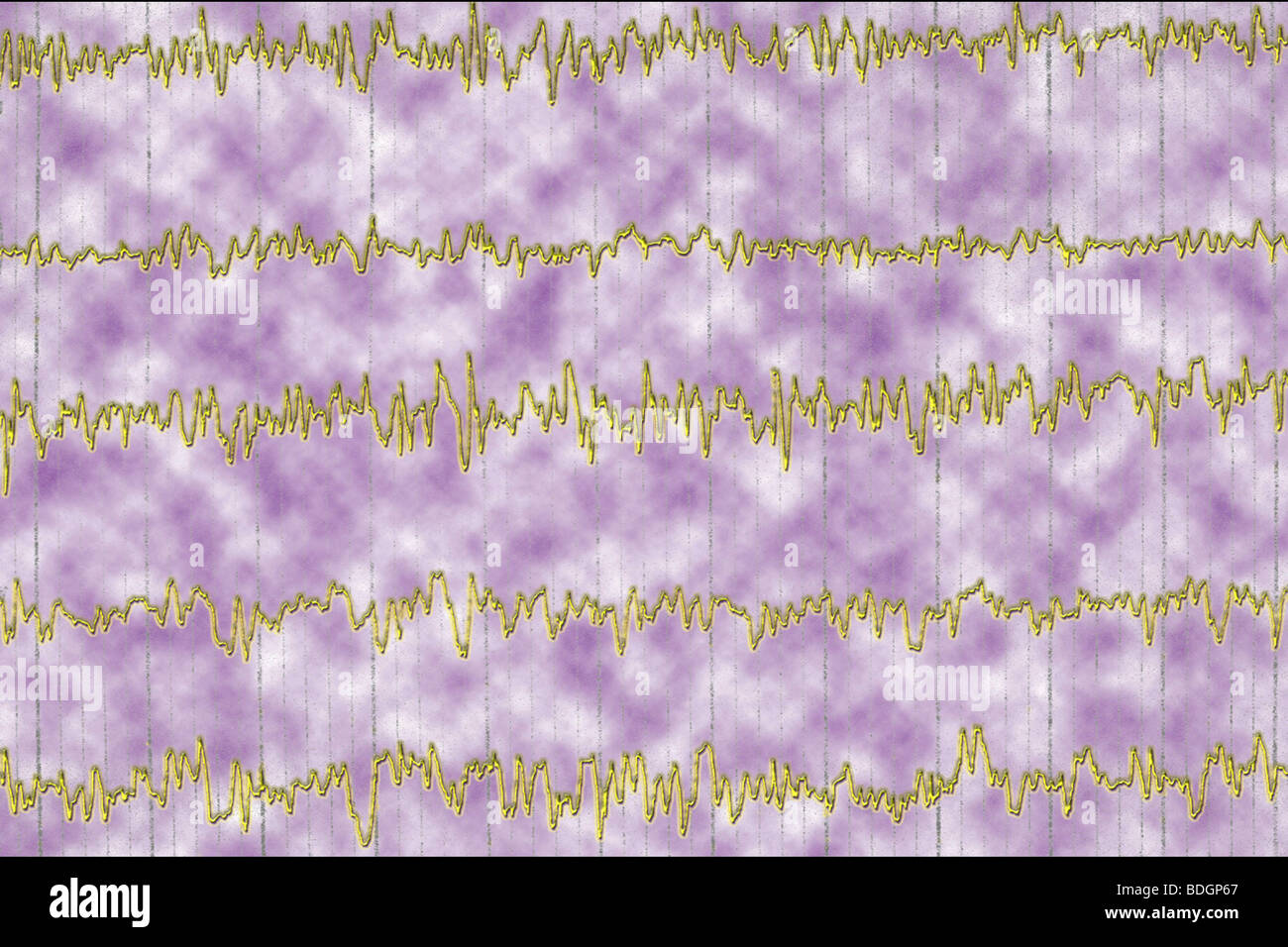 Eeg imaging hi-res stock photography and images - Alamy
