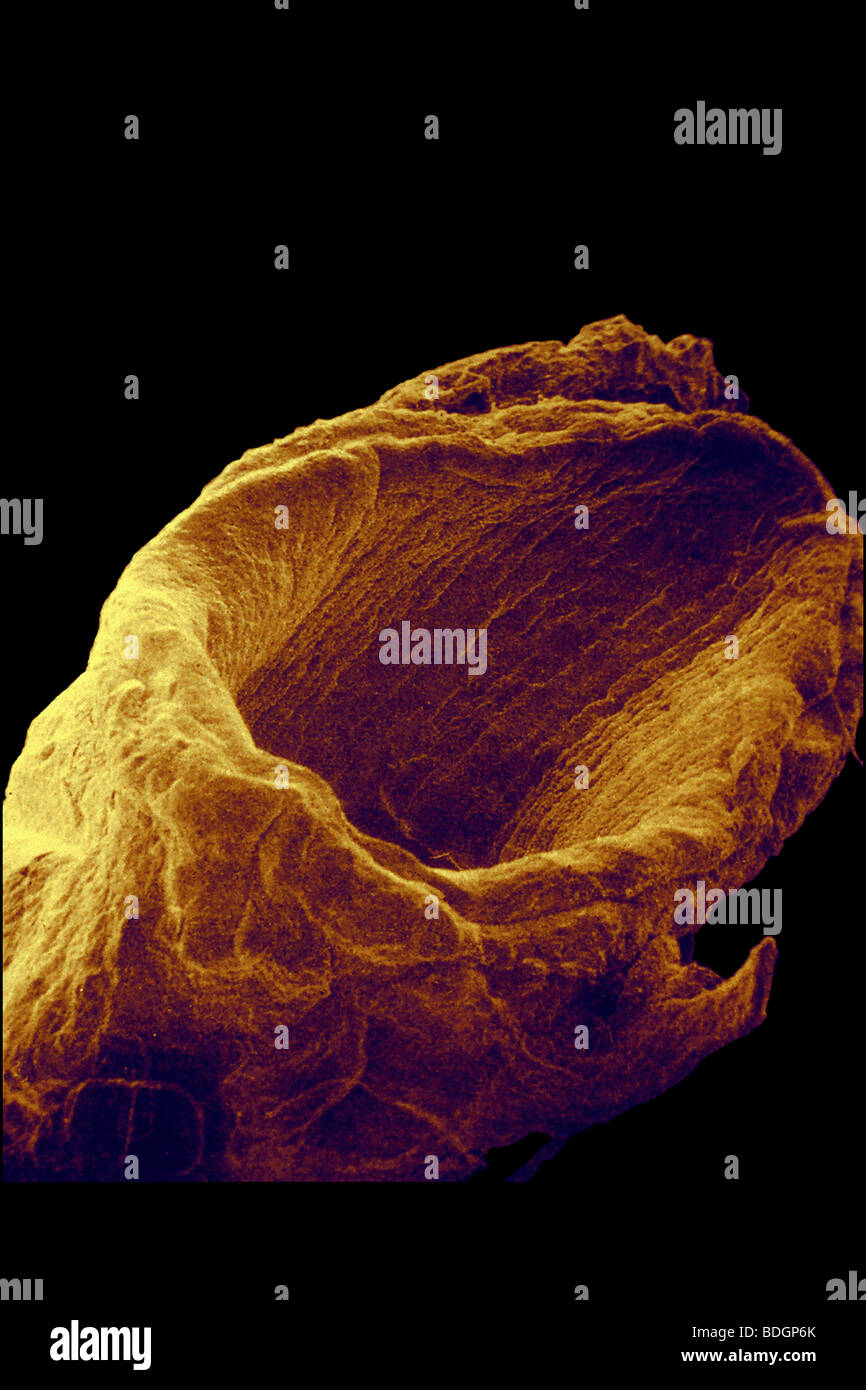 Electron microscopy vein hi-res stock photography and images - Alamy