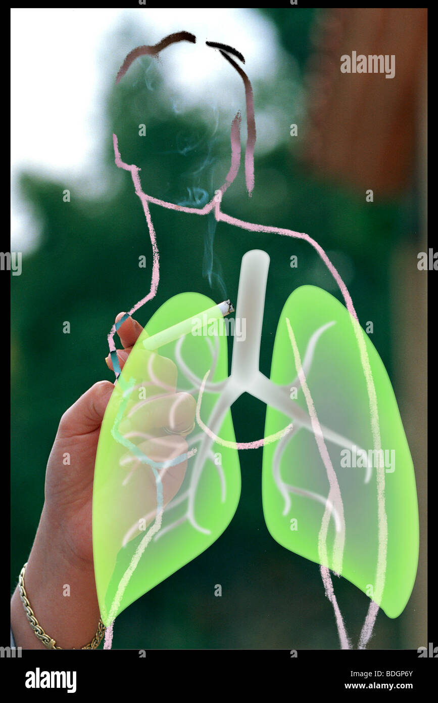 LUNG CANCER, DRAWING Stock Photo - Alamy