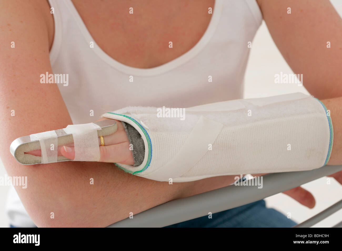 Arm splint hi-res stock photography and images - Alamy