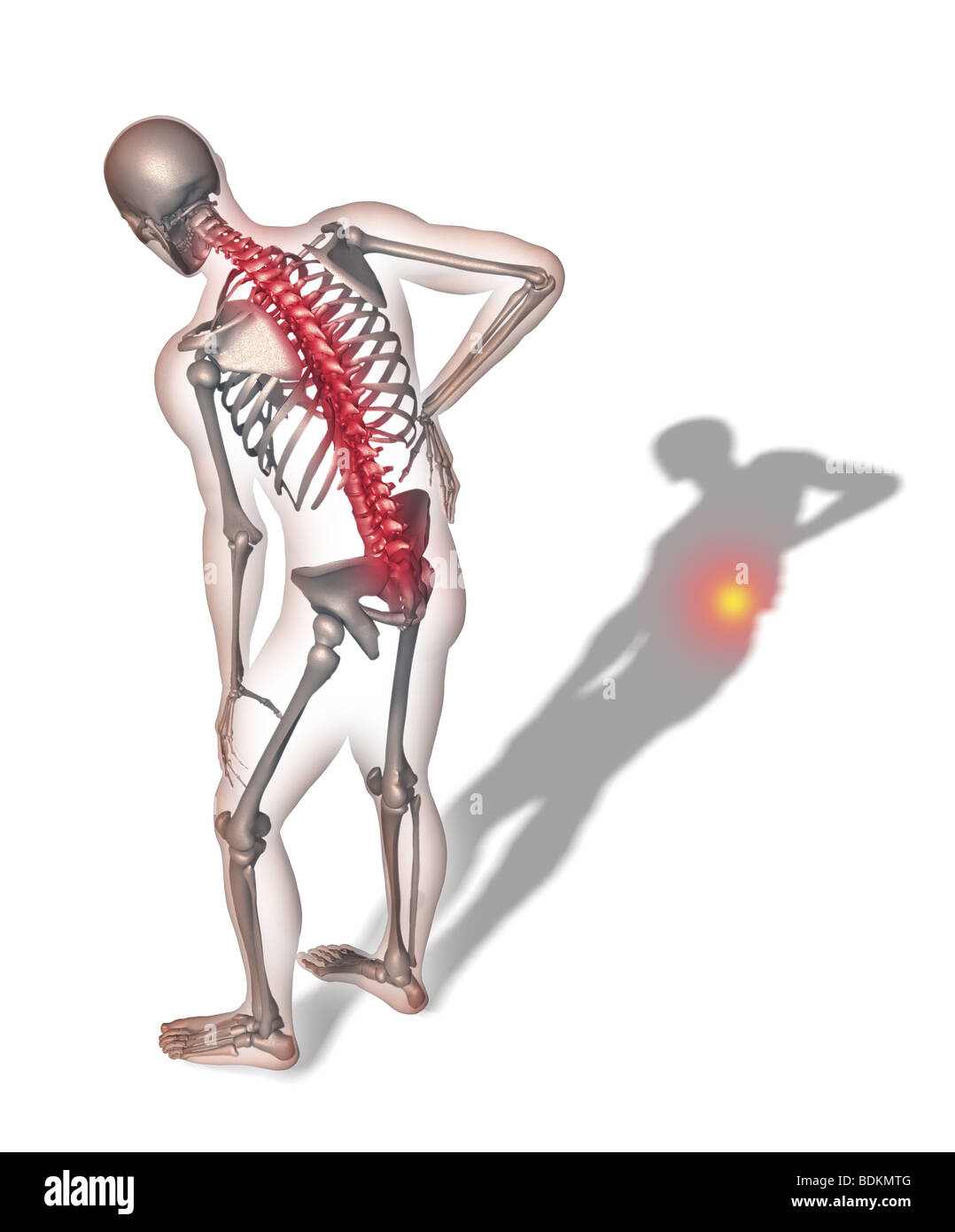 Illustration depicting back pain Stock Photo - Alamy Illustration depicting back pain Stock Photo - Alamy