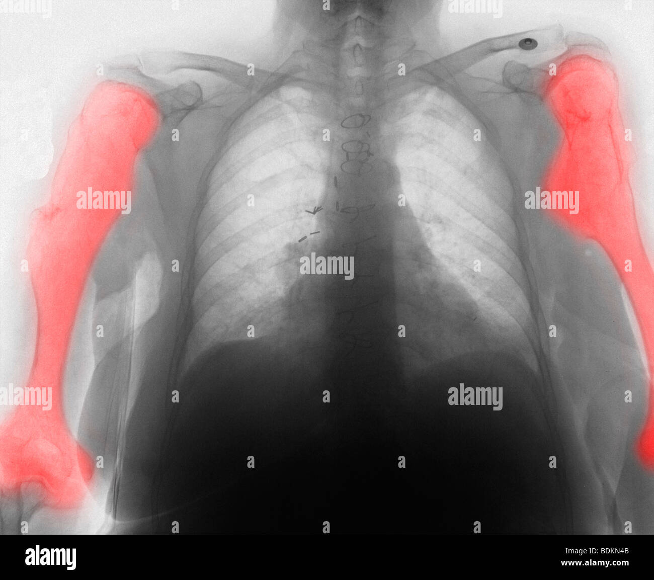 Congenital abnormality hi-res stock photography and images - Alamy