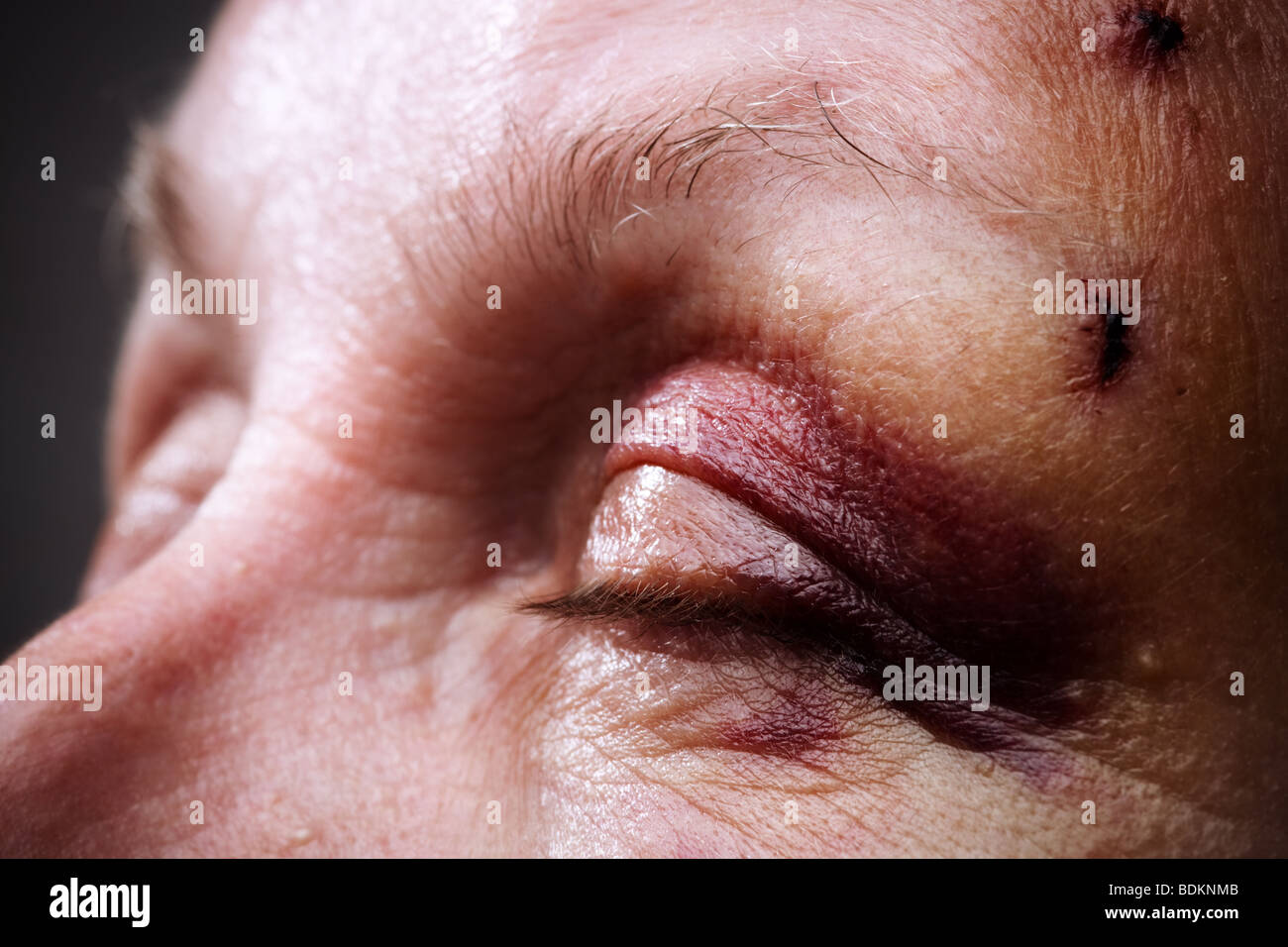 Real trauma hi-res stock photography and images - Alamy