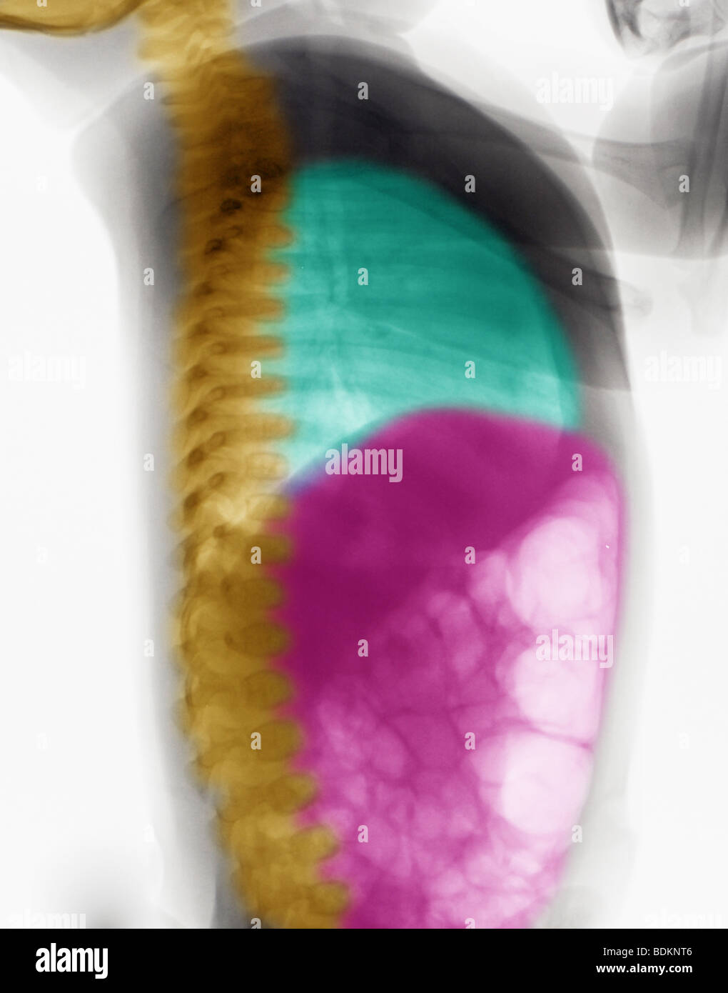 normal x-ray of a 2 month old female showing chest and abdomen Stock ...