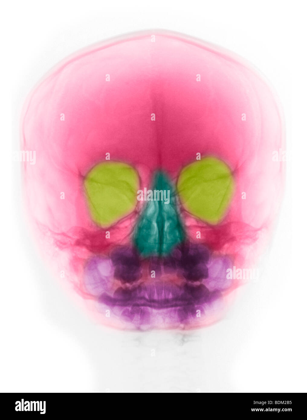Normal skull x ray hi-res stock photography and images - Alamy