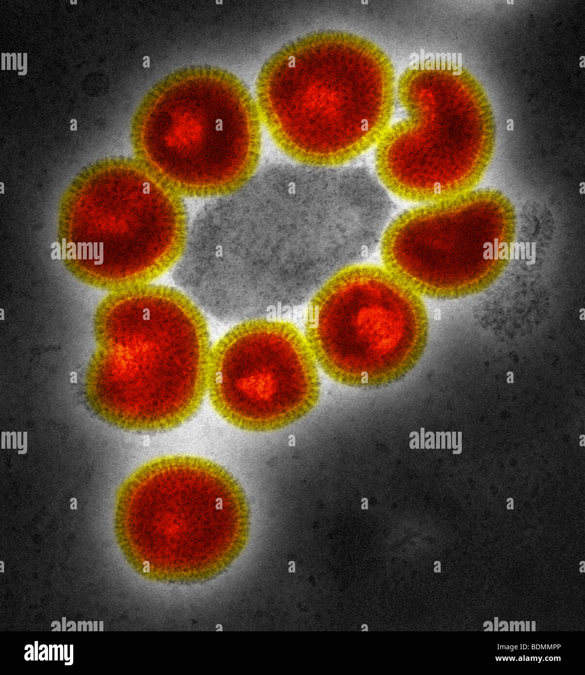 Negative-stained transmission electron micrograph (TEM) of a number of ...