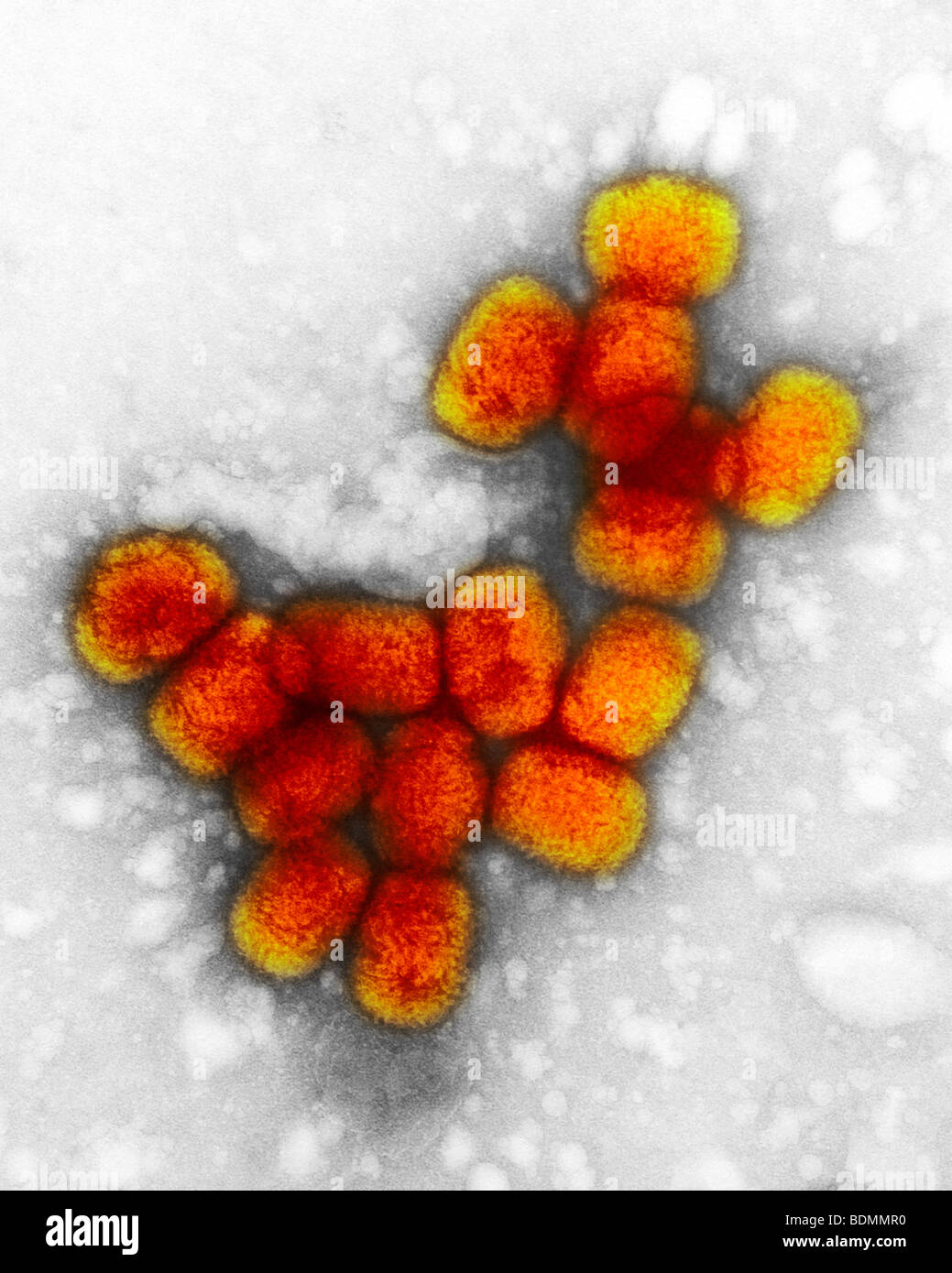 Smallpox hi-res stock photography and images - Alamy
