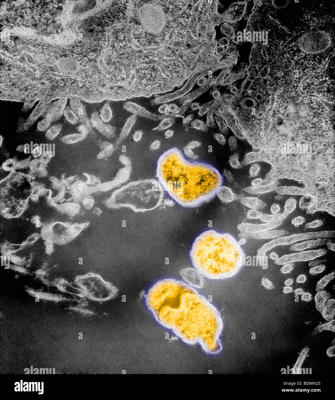 Transmission electron micrograph (TEM) of Gram-negative Orientia ...